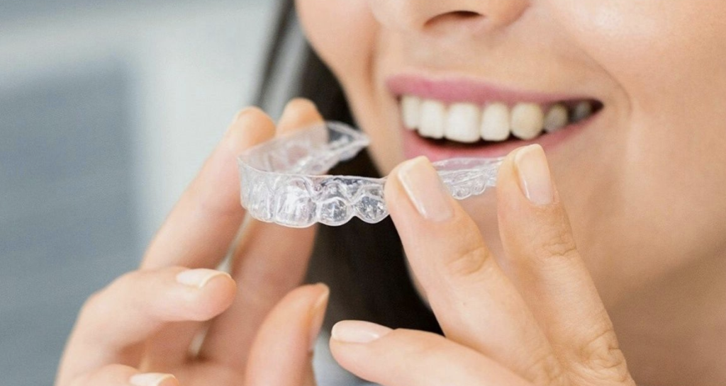 How Clear Aligners Help Improve Teeth Alignment Without Metal Brackets ...
